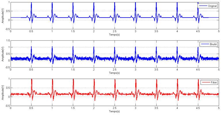 Traitement du Signal | Matlab #3: Filtrage numérique – Analyse du ...