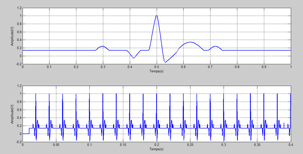 Traitement du signal | Matlab #2: Synthèse d’un signal ECG Périodique ...