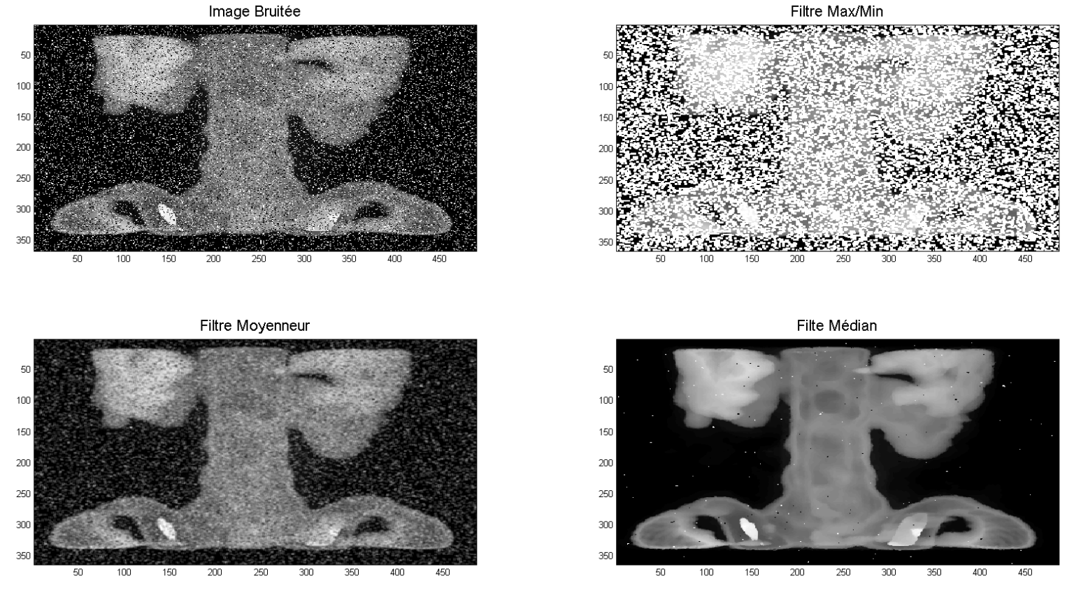Le filtre Médian avec Matlab – Cours & Projets
